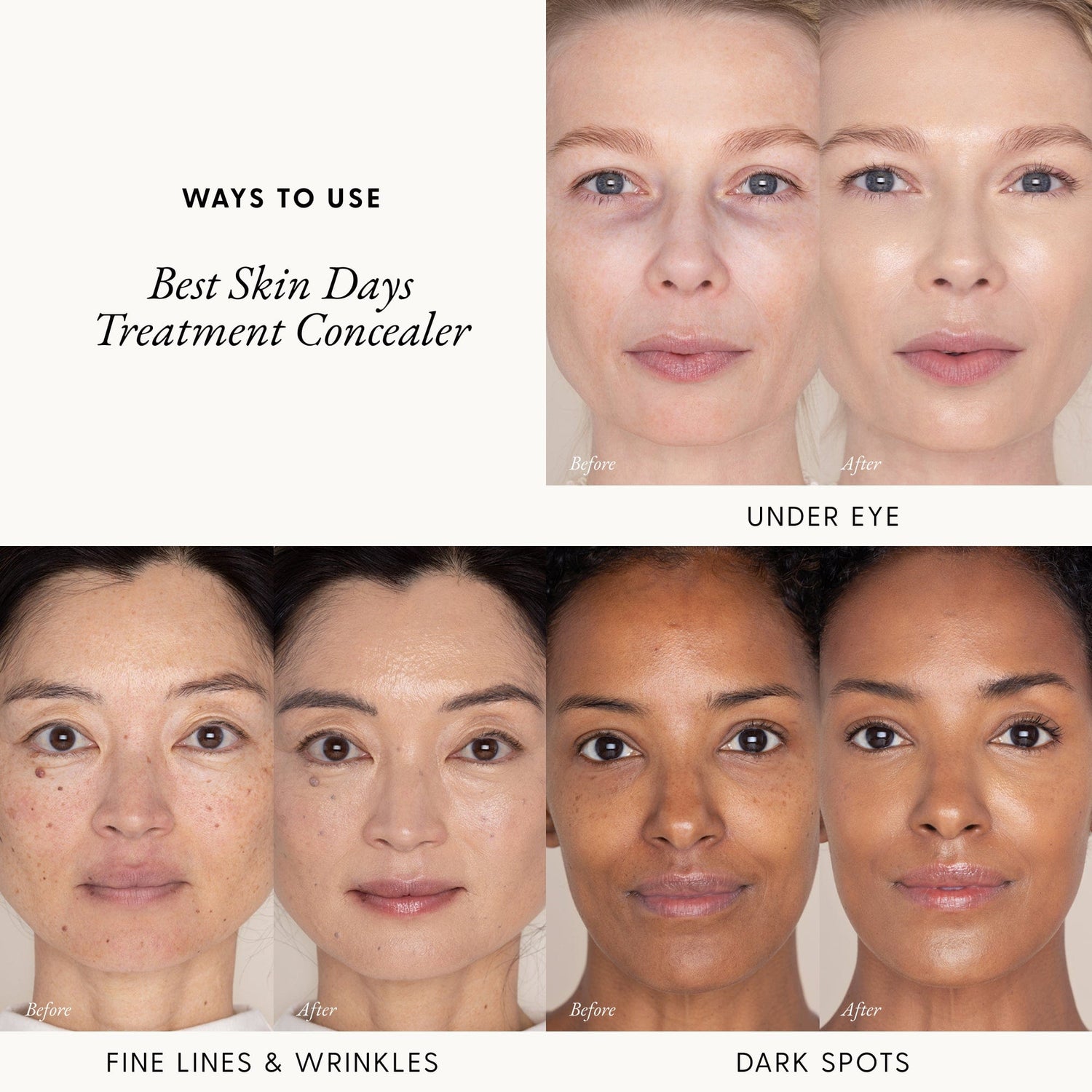 Best Skin Days™ Treatment Concealer Award Winning Dark Circles Eye ...