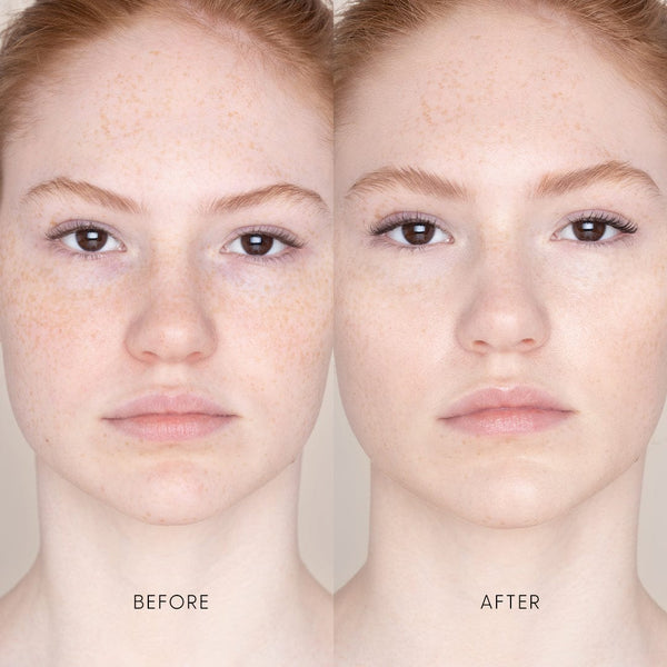 Best Skin Days™ Treatment Concealer – Iris&Romeo